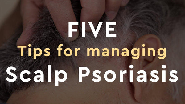 5 Tips for Managing Scalp Psoriasis – Psoriasis Honey